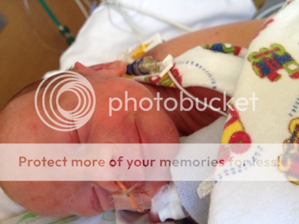 Born at 31 weeks - BabyCenter